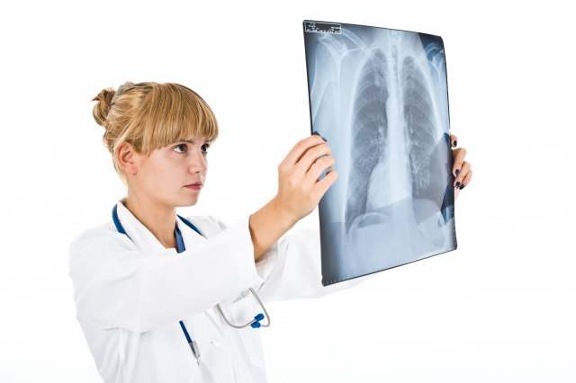 Rak pluća je najagresivniji karcinom: Uz pomoć imunoterapije se leči više od 700 osoba kod nas ...